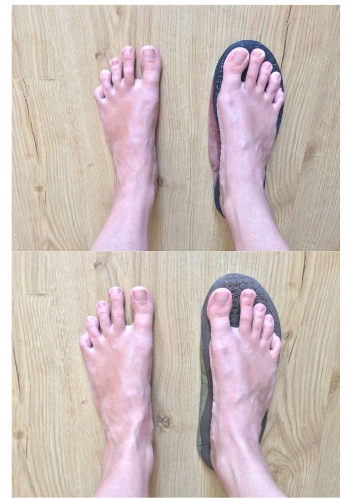 Jak palec u nohy nastavuje krční páteř [Barefoot speciál 1]